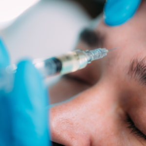 Viora Skin Tightening Treatment in Ramamurthy Nagar | Bangalore